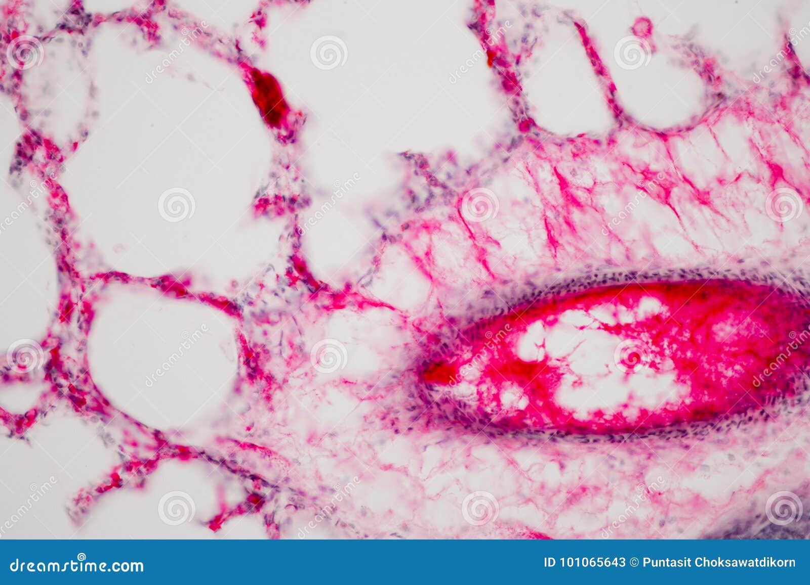 Human Lung Tissue Under Microscope View. Stock Image - Image of cancer ...