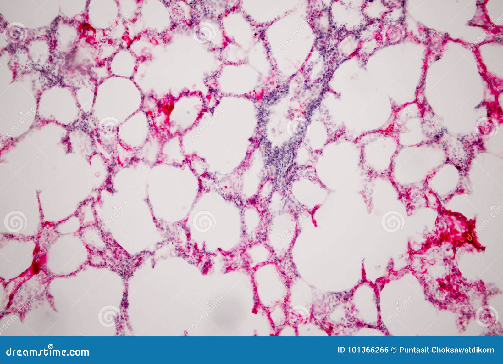 Human Lung Tissue Under Microscope View. Stock Photo - Image of inhale ...