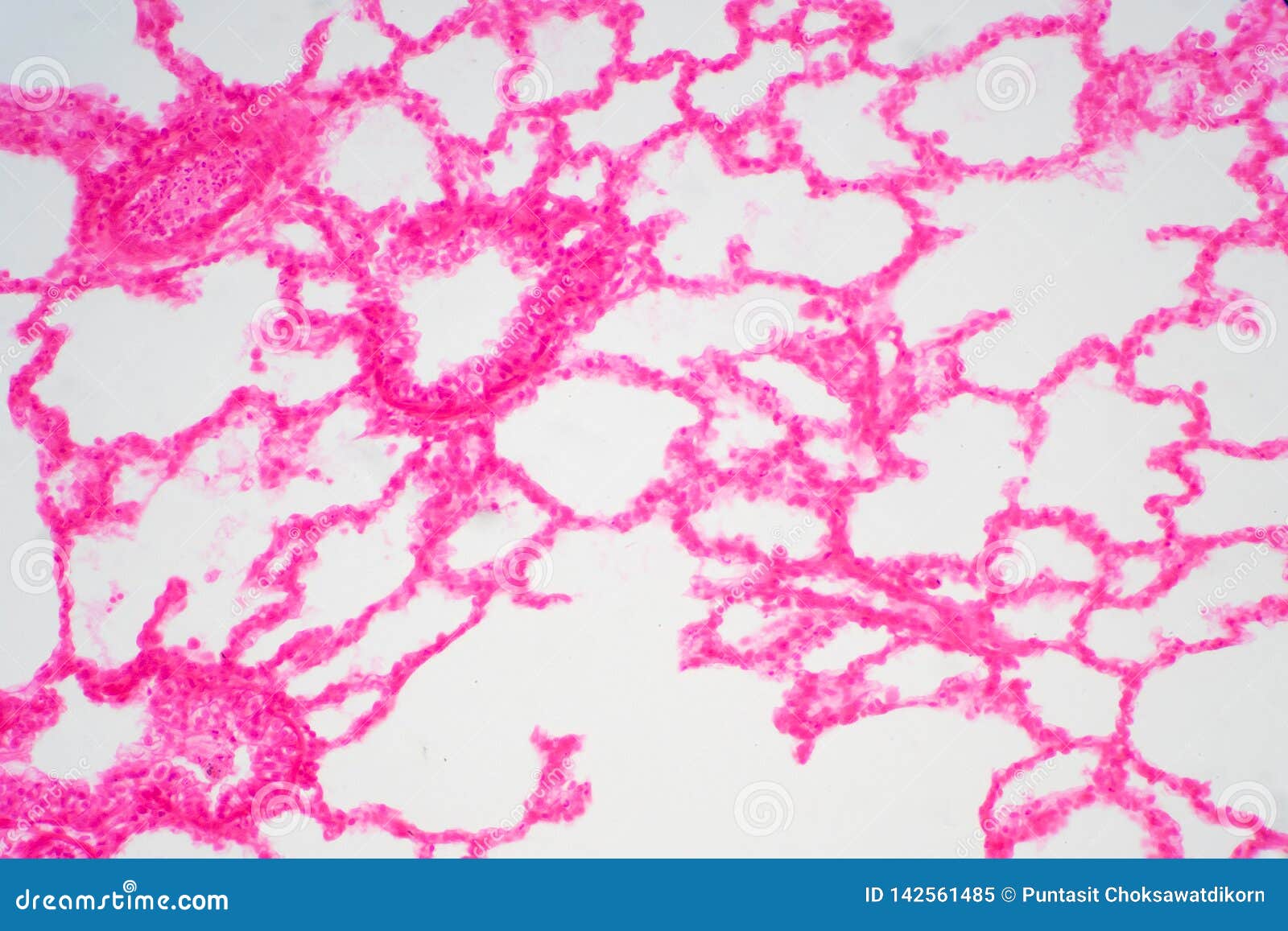 Human Lung Tissue Under Microscope View Stock Image - Image of care ...