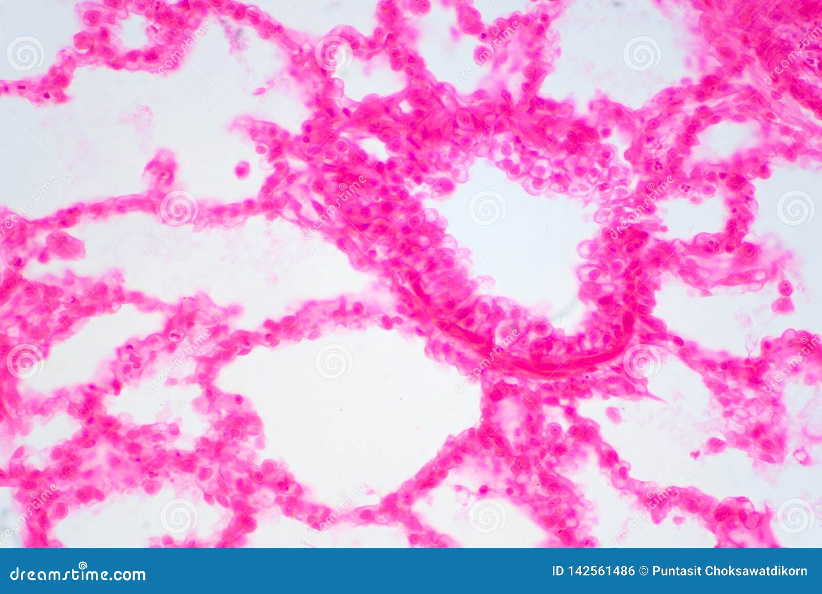 Human Lung Tissue Under Microscope View Stock Photo - Image of lungs ...