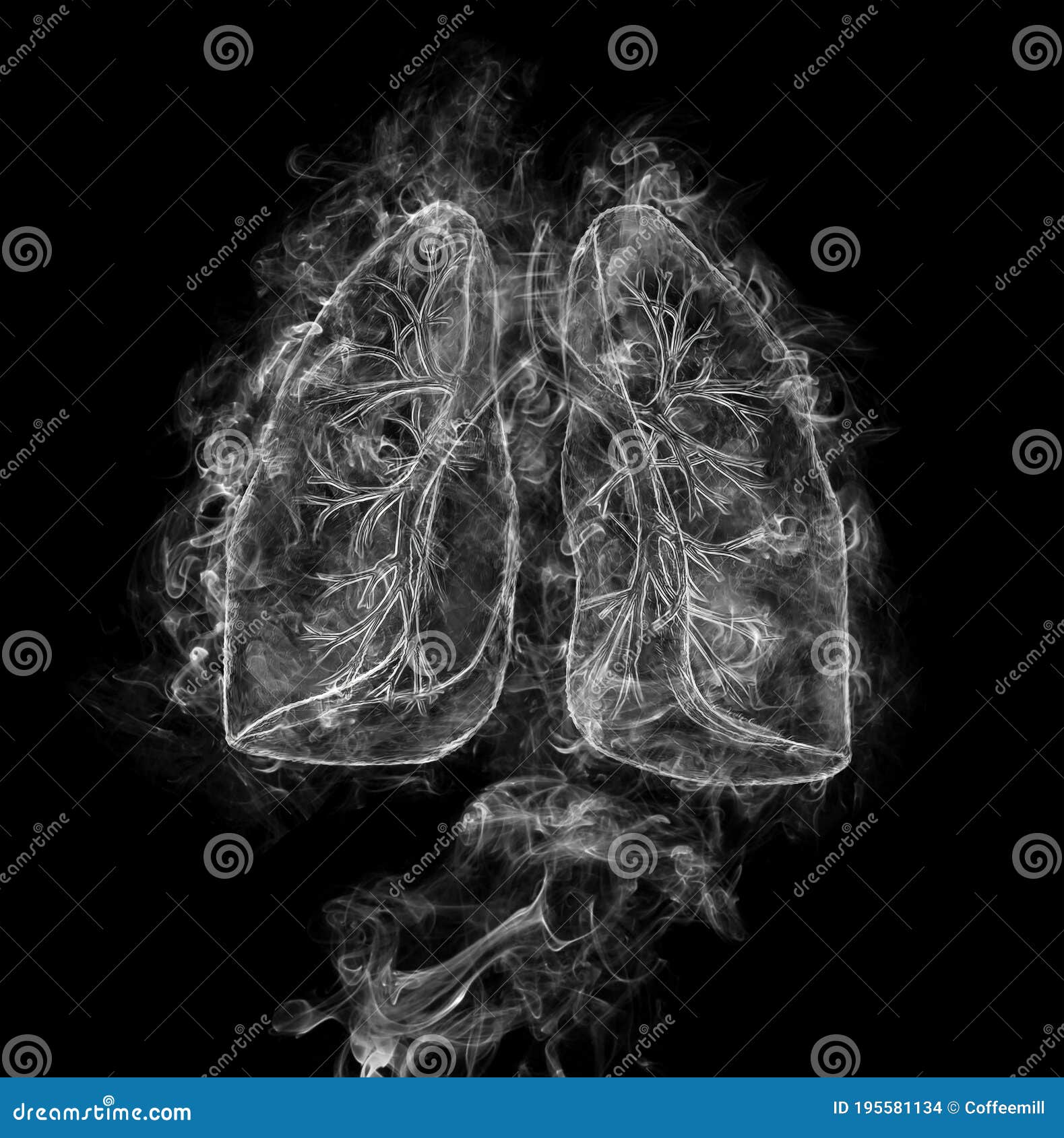 Human lungs and bronchi stock photo. Image of cancer - 195581134