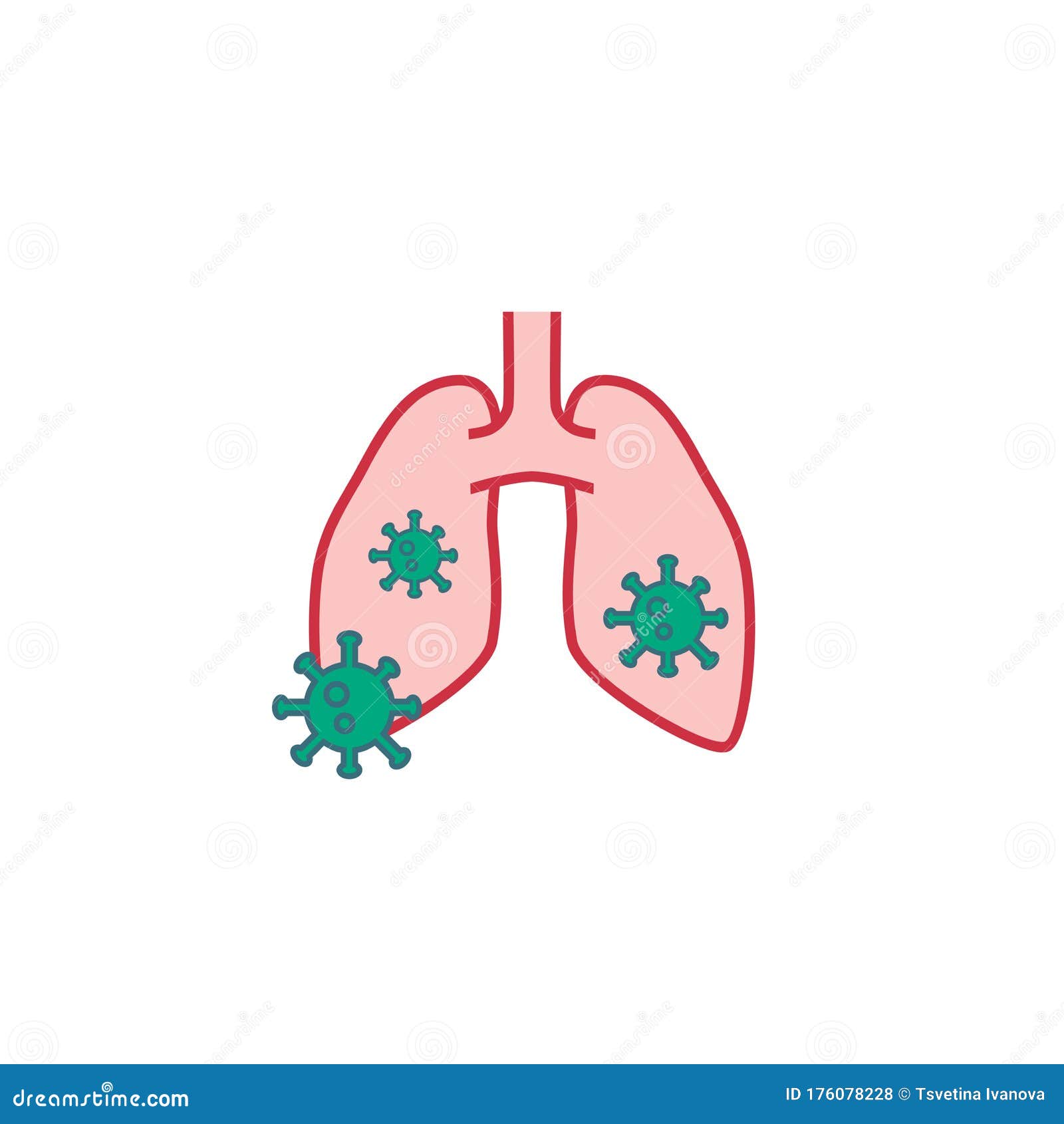 Human Lungs with Coronavirus Colorful Vector Cartoon. Stock Vector ...