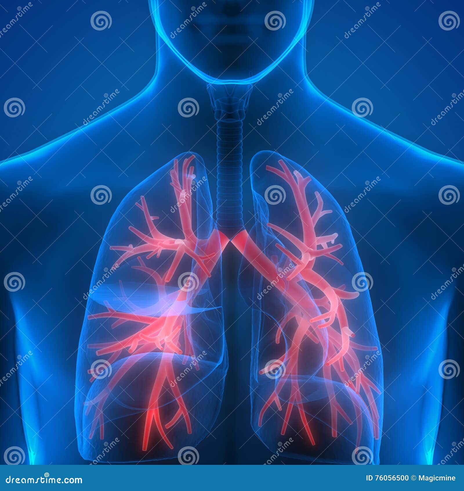 Bronchioles Cartoons, Illustrations & Vector Stock Images - 3185 ...