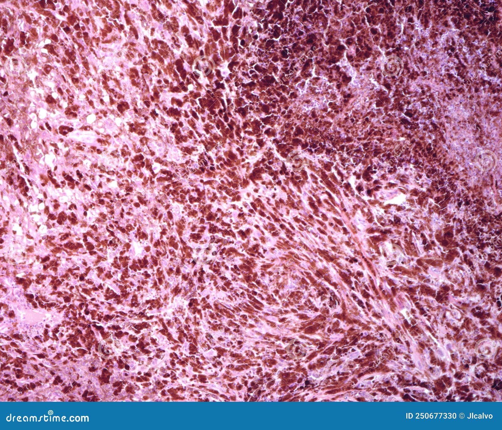 Lymph Node Cells Under The Microscope. Royalty-Free Stock Image ...