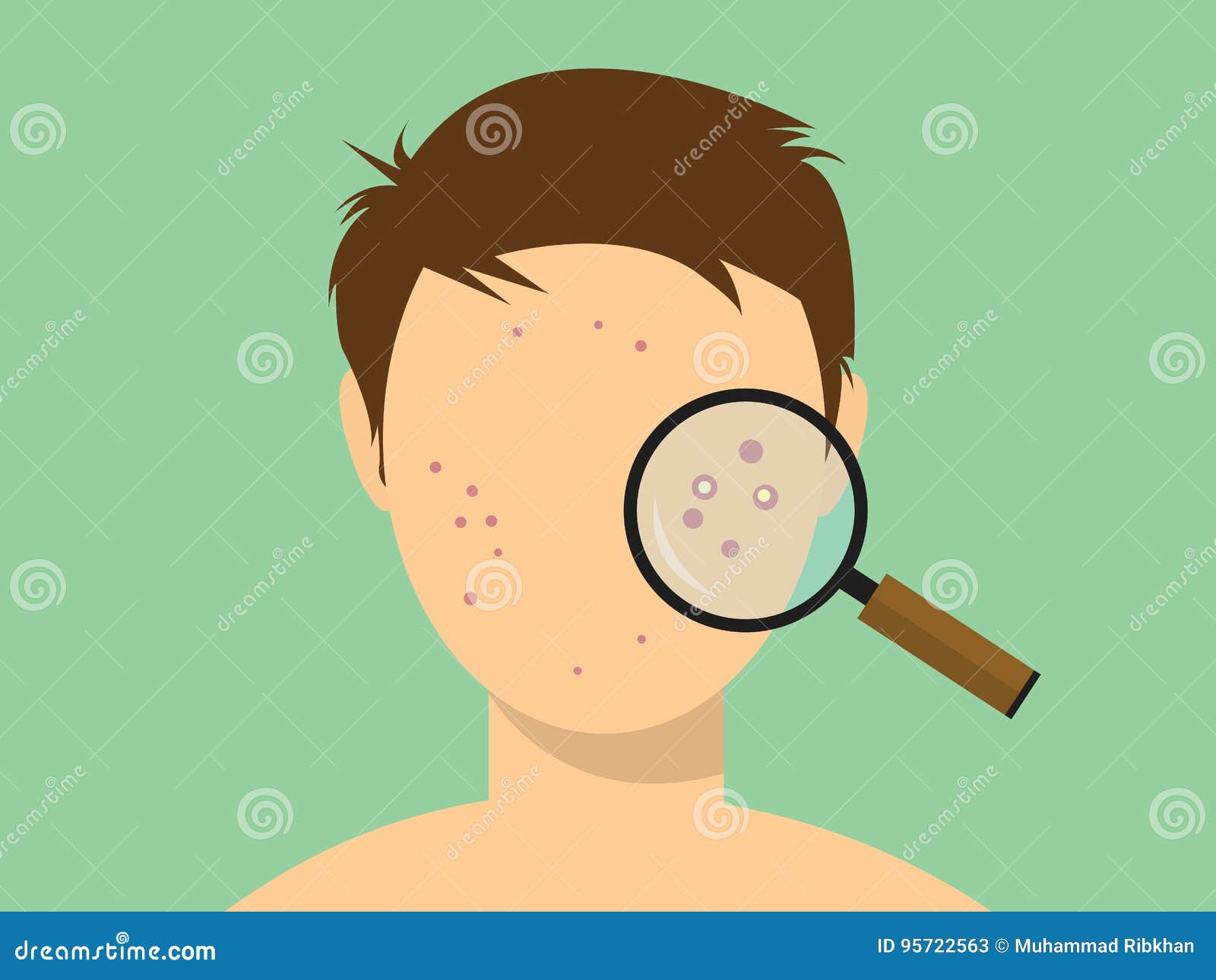 Acne Face Sad Girl Icon Illustration Cartoon Vector | CartoonDealer.com ...