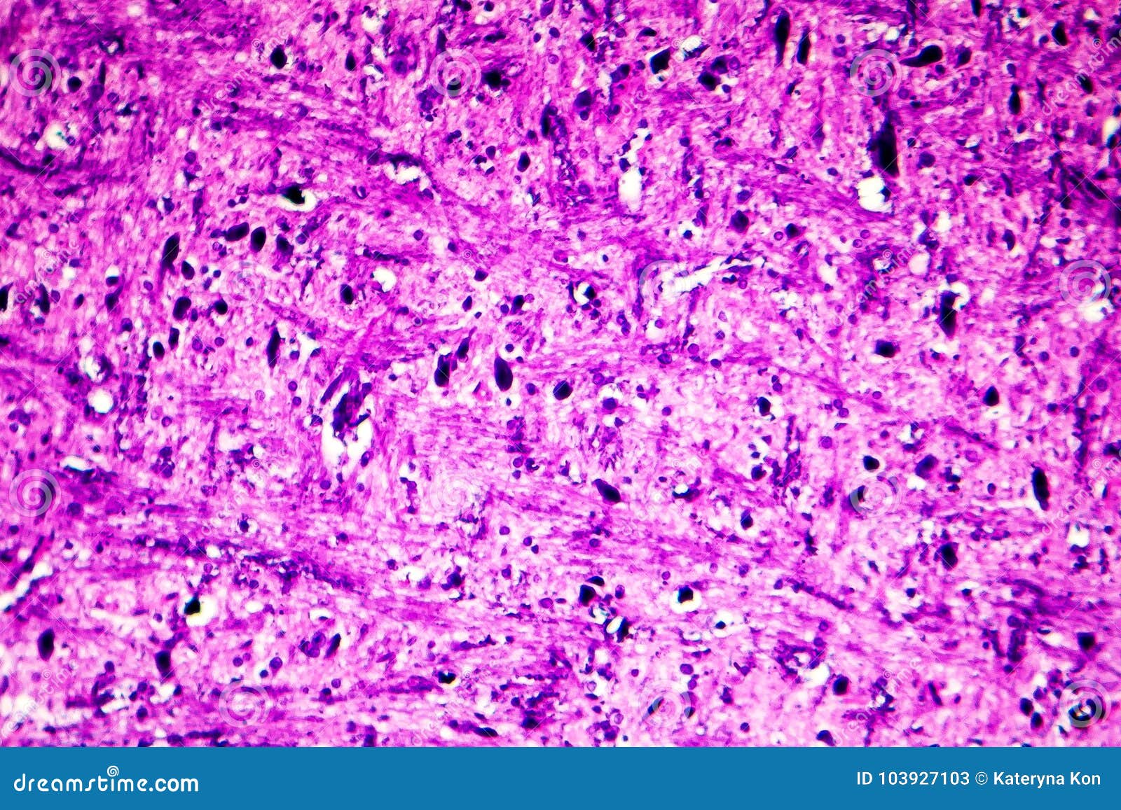 Human medulla oblongata stock image. Image of brain - 103927103