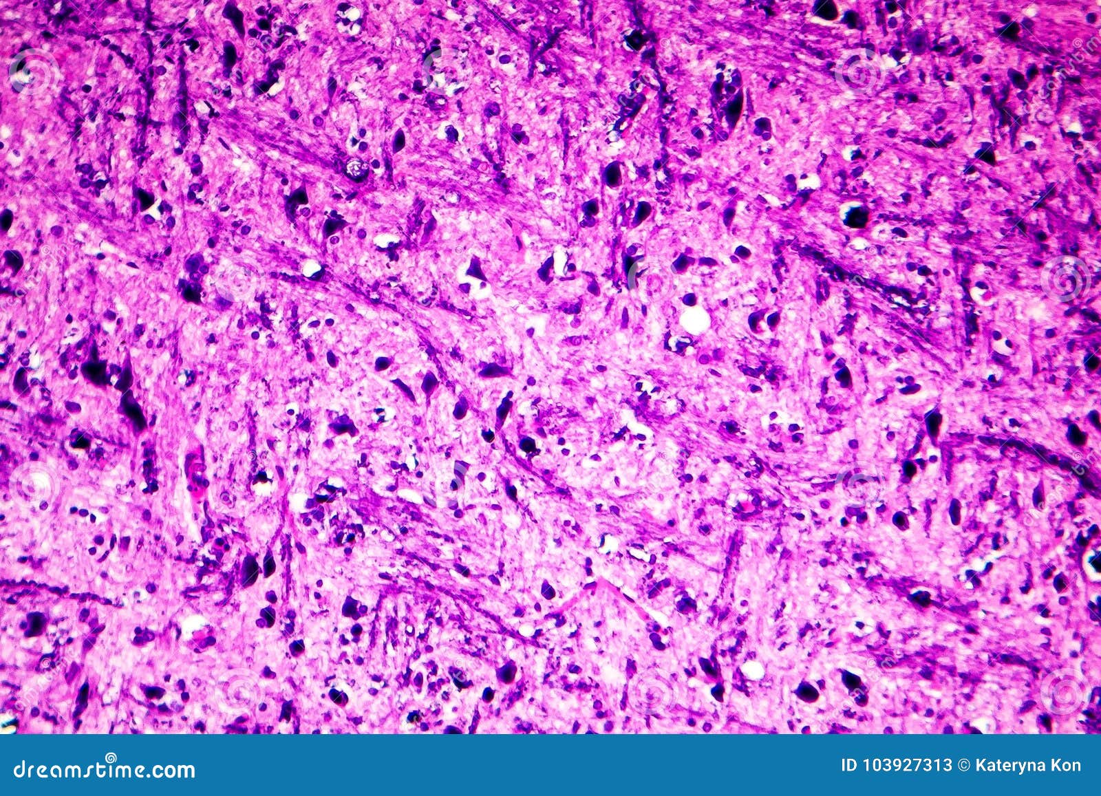 Human medulla oblongata stock image. Image of ultrastructure - 103927313