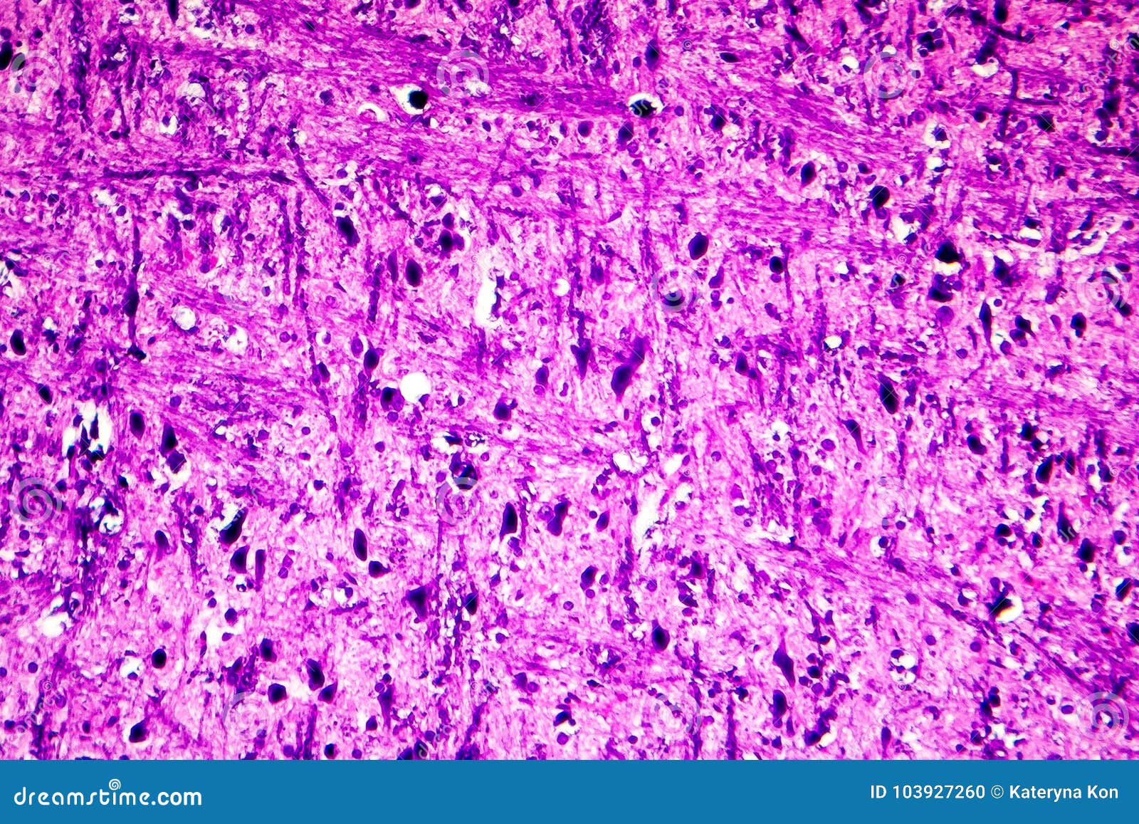 Medulla Oblongata Histology