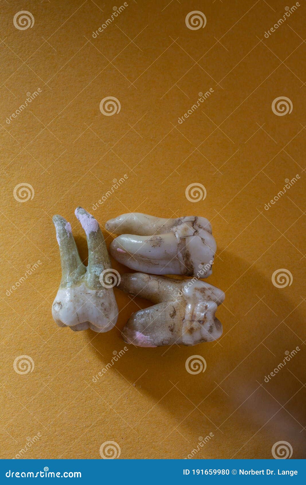 Human Molars with Tooth Roots Stock Photo - Image of chew, human: 191659980