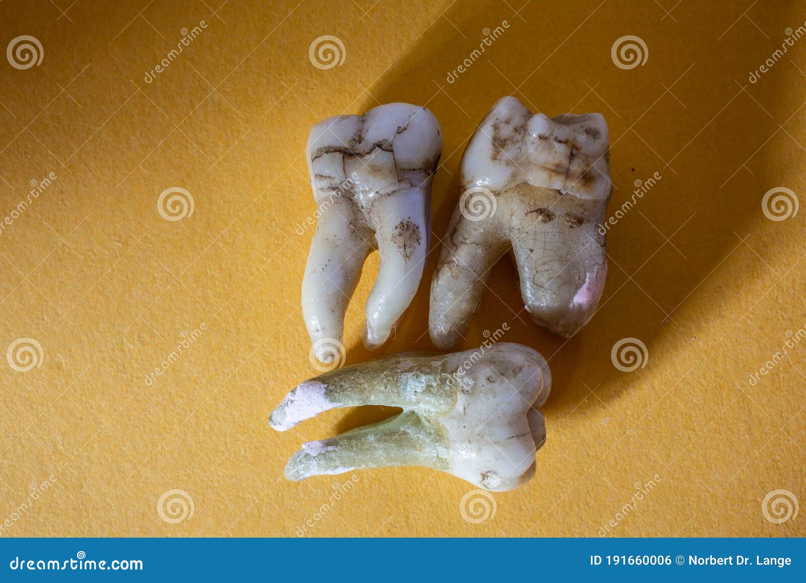 Human Molars with Tooth Roots Stock Photo - Image of bite, white: 191660006