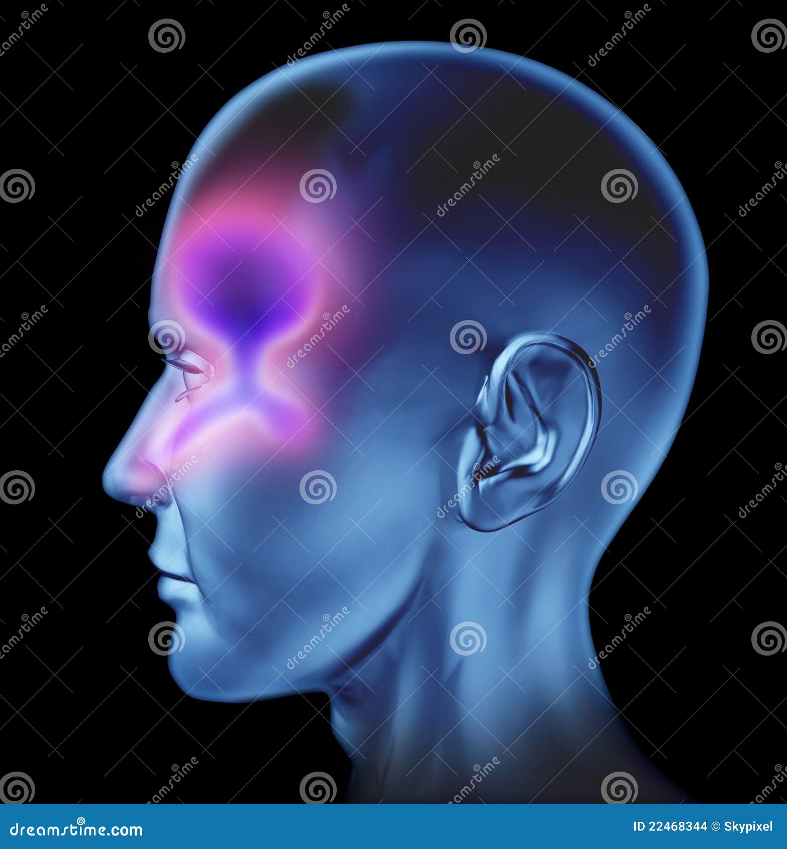 Human Congestion Stock Illustrations – 495 Human Congestion Stock ...