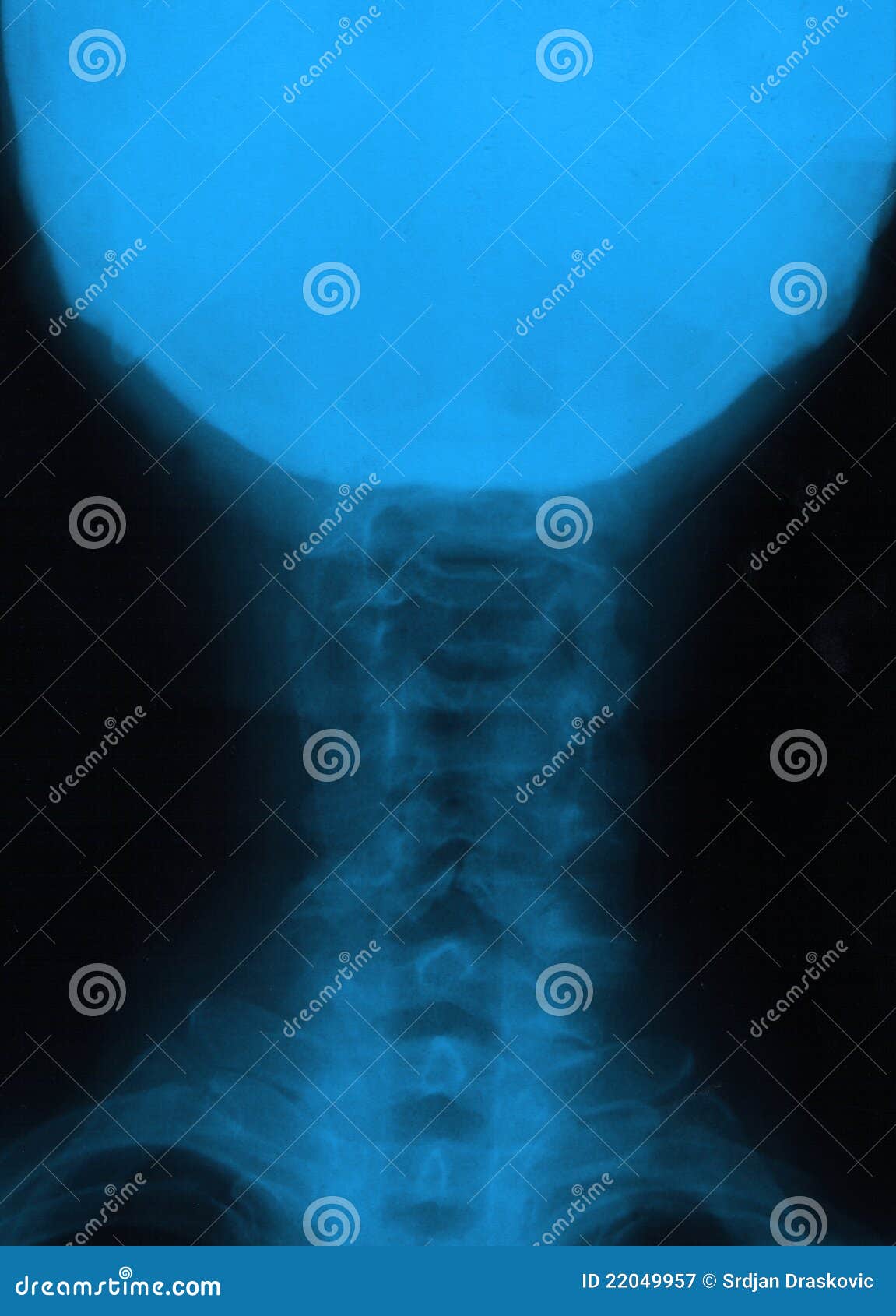 Human neck stock image. Image of roentgen, clinic, report - 22049957