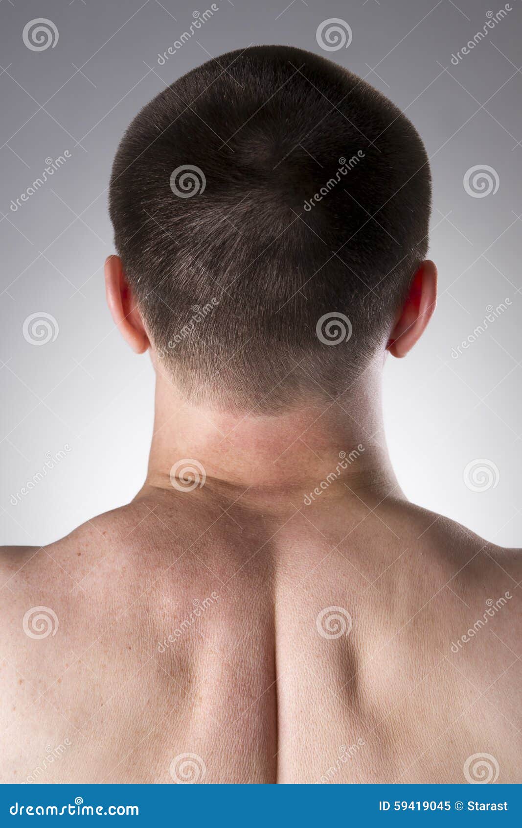 Human neck close-up stock image. Image of hurt, scoliosis - 59419045