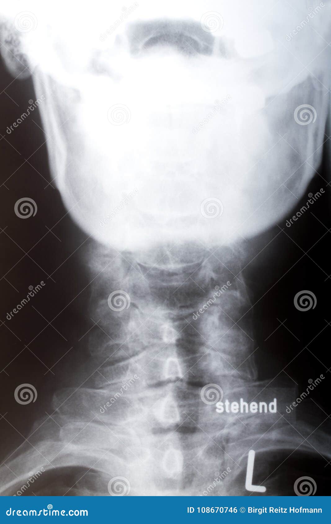 Human neck in front stock photo. Image of cervical, skeleton - 108670746