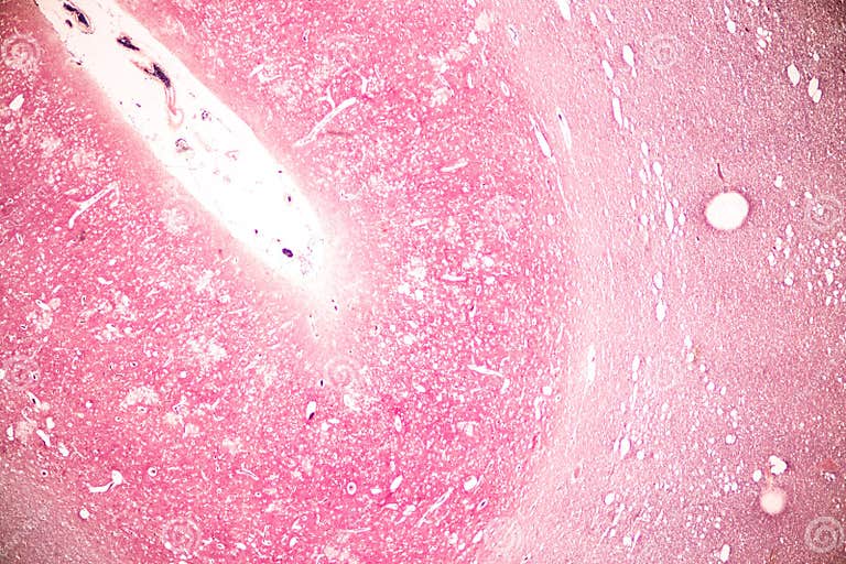 Human Nervous System Under the Microscope in Lab. Stock Image - Image ...