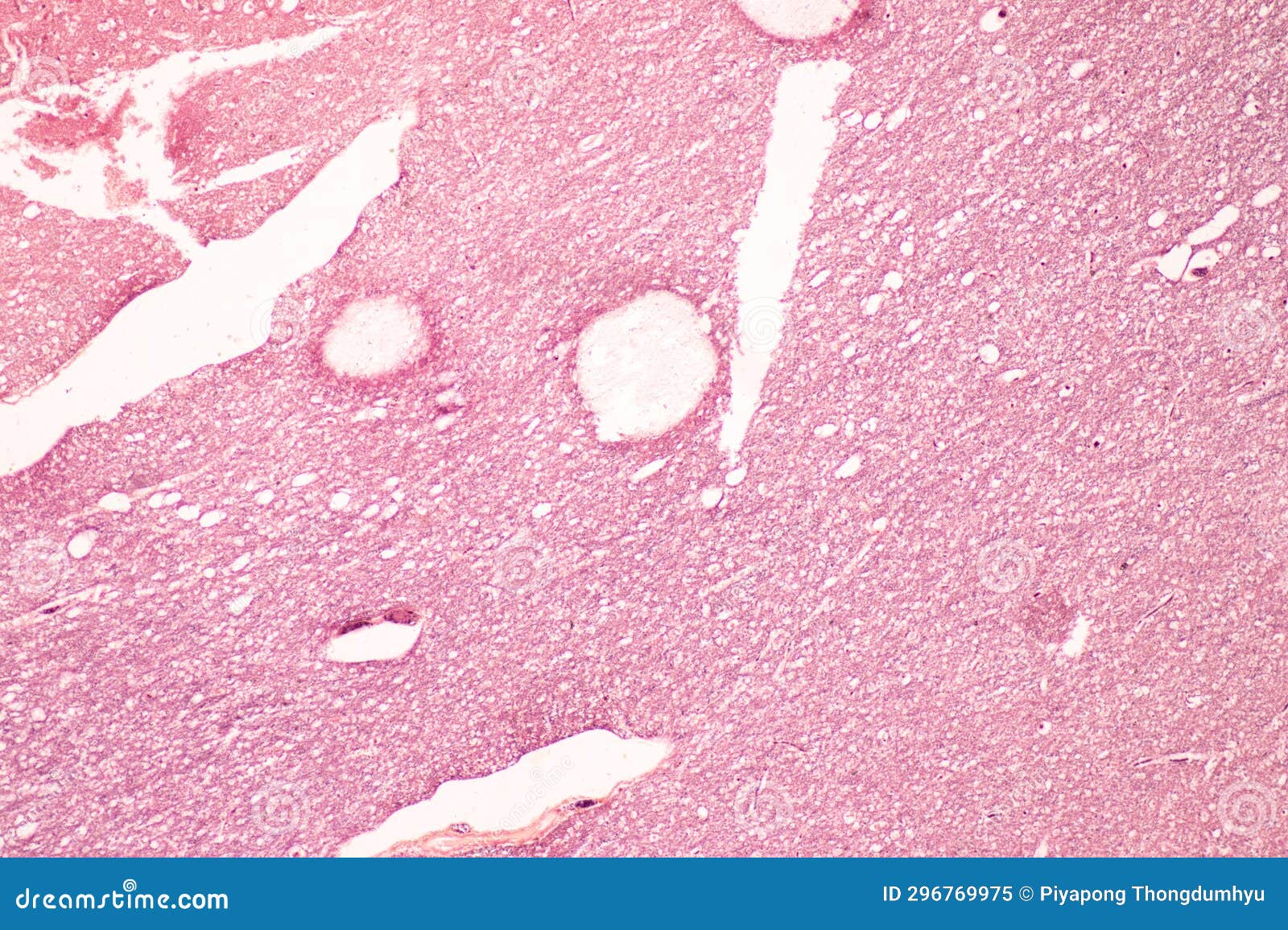 Human Nervous System Under the Microscope in Lab. Stock Image - Image ...