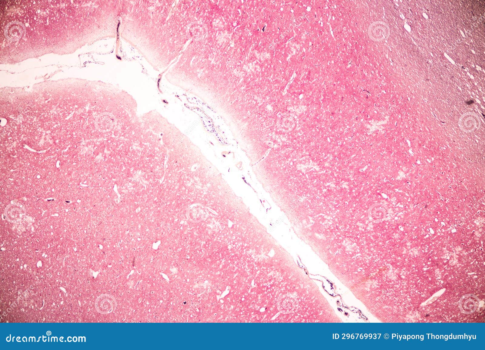 Human Nervous System Under the Microscope in Lab. Stock Image - Image ...