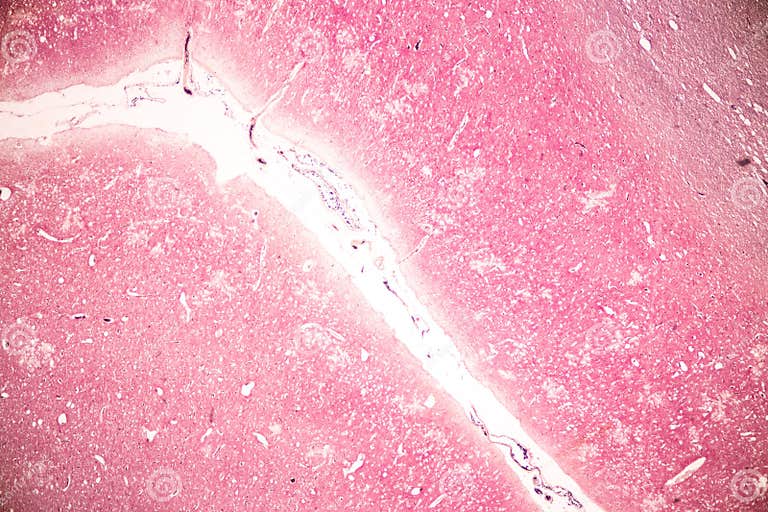 Human Nervous System Under the Microscope in Lab. Stock Image - Image ...