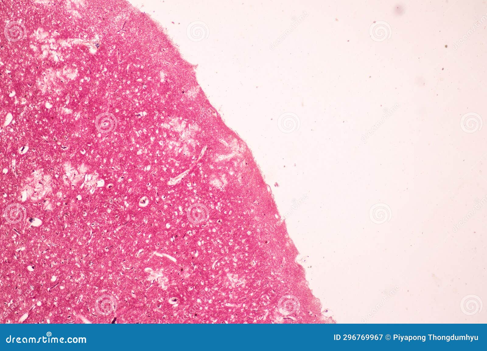 Human Nervous System Under the Microscope in Lab. Stock Image - Image ...