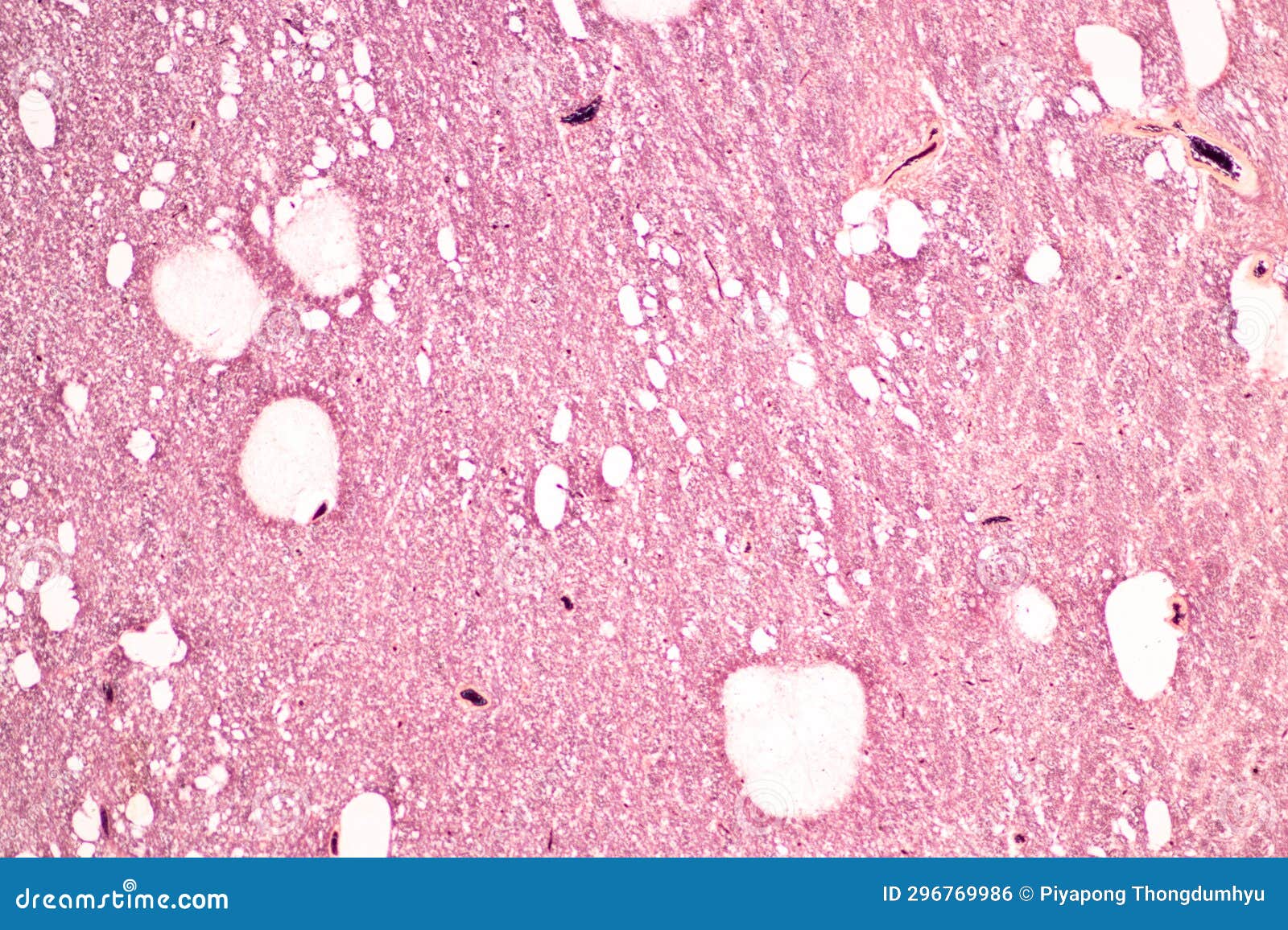 Human Nervous System Under the Microscope in Lab. Stock Photo - Image ...