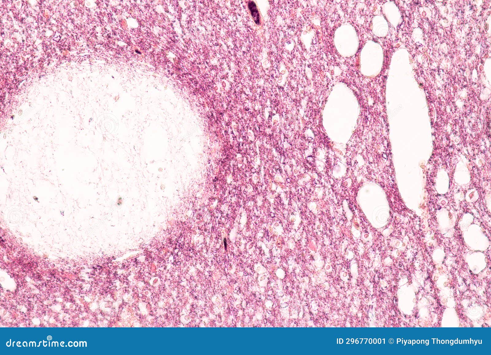 Human Nervous System Under the Microscope in Lab. Stock Image - Image ...