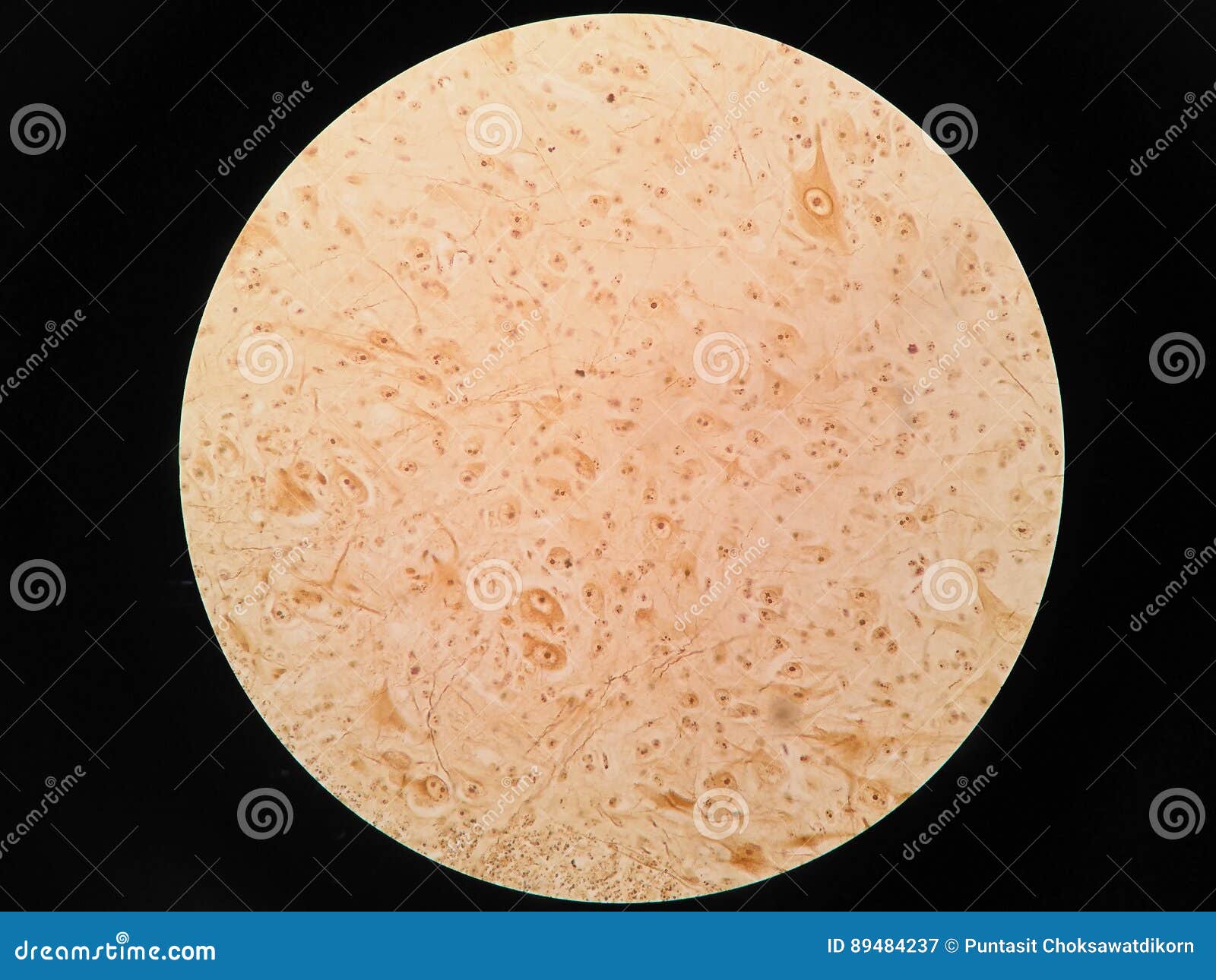 Human neurons cells stock image. Image of healthcare - 89484237 Human neurons cells stock image. Image of healthcare - 89484237