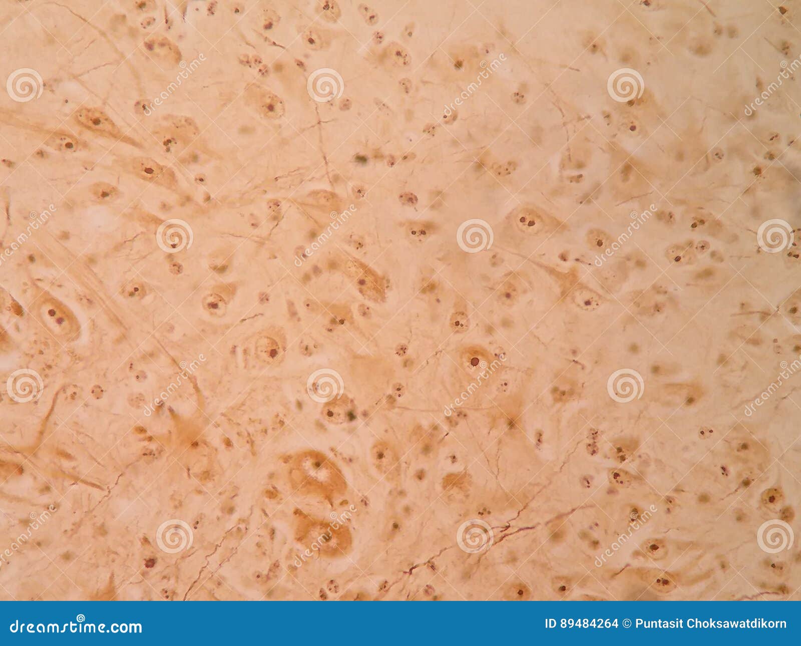 Human neurons cells stock photo. Image of biology, myelin - 89484264 Human neurons cells stock photo. Image of biology, myelin - 89484264