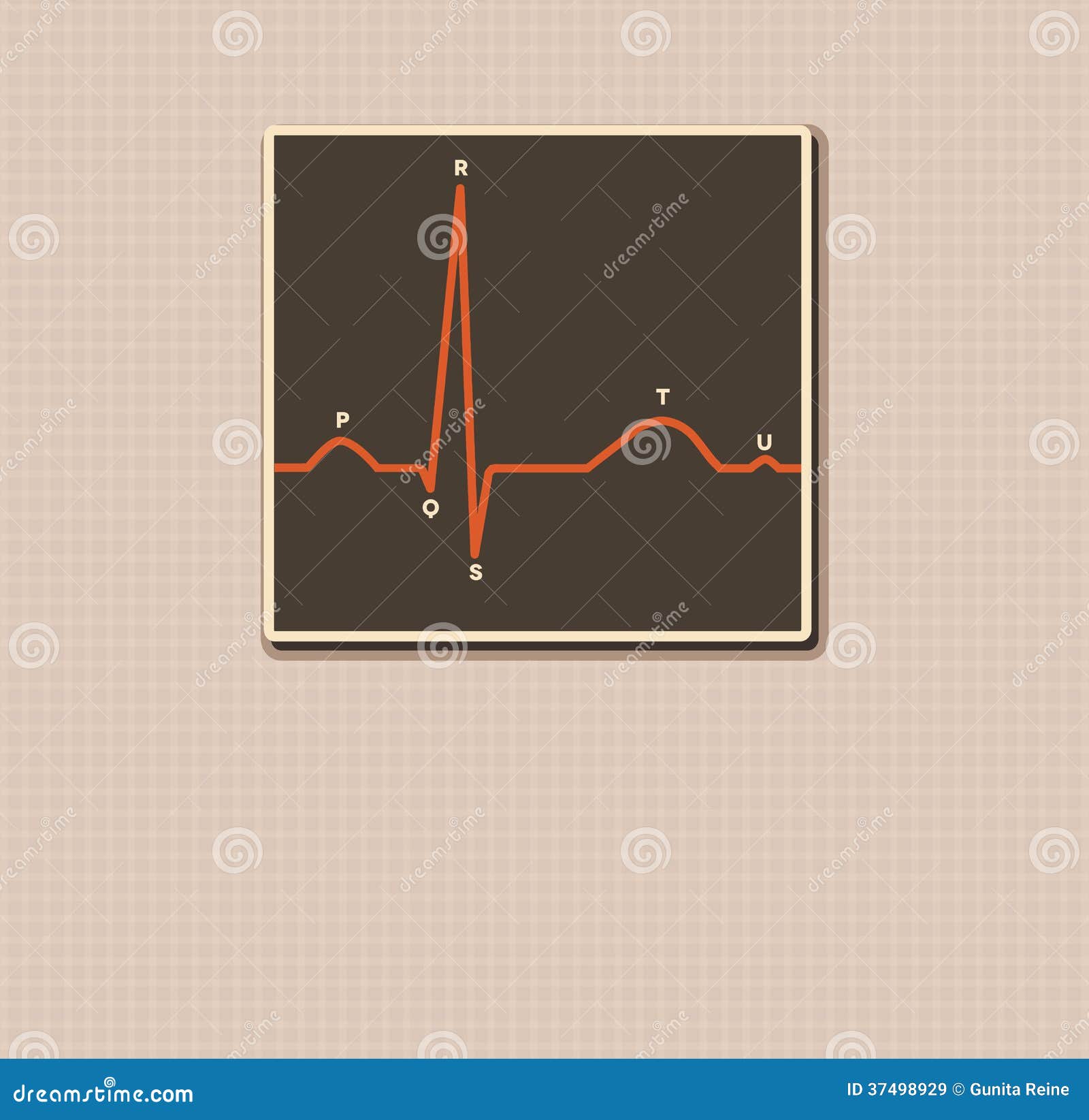 Heart Normal Sinus Rhythm On Electrocardiogram Cartoon Vector ...