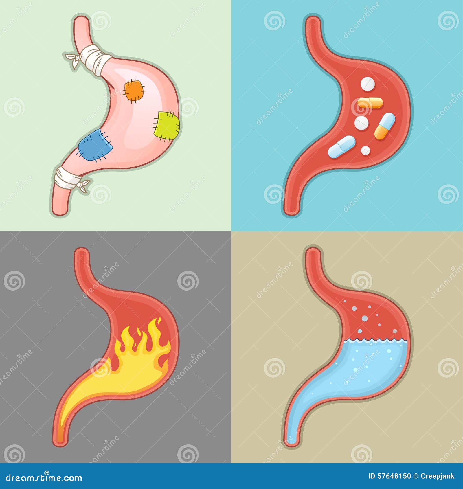 Human Organ - Stomach ache stock vector. Illustration of sign - 57648150