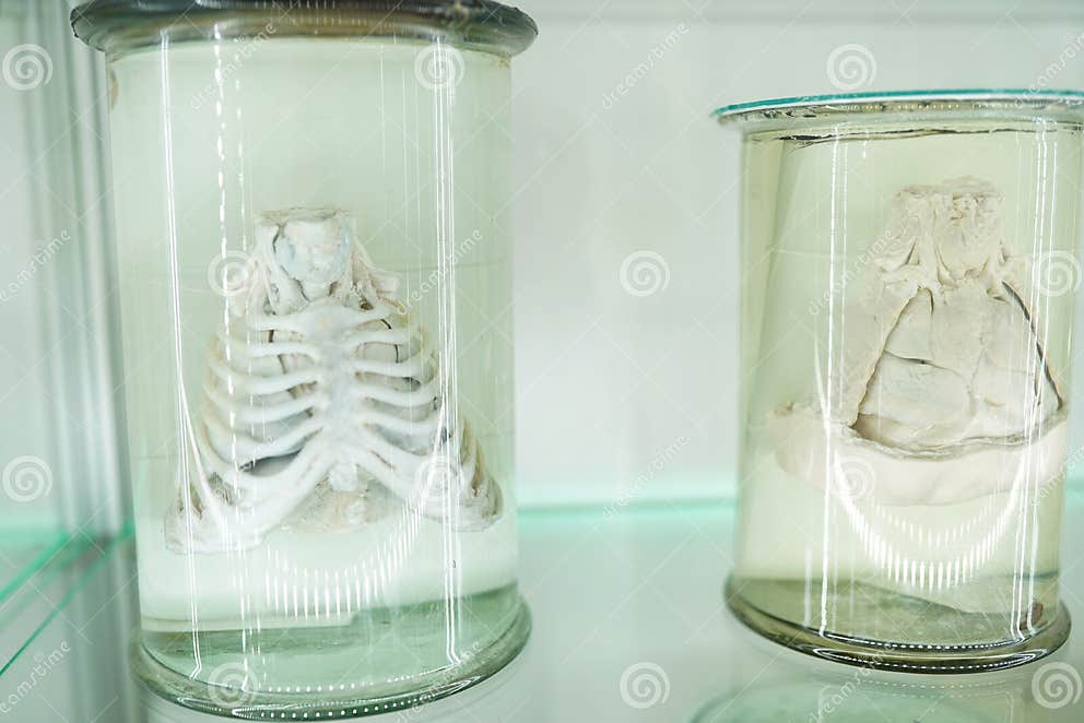 Human Organs in Formalin in Anatomical Museum Editorial Photography ...