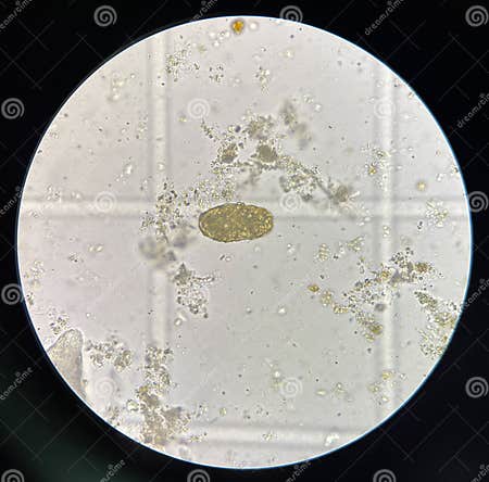 Human Parasite in Stool Examination. Stock Image - Image of anatomy ...