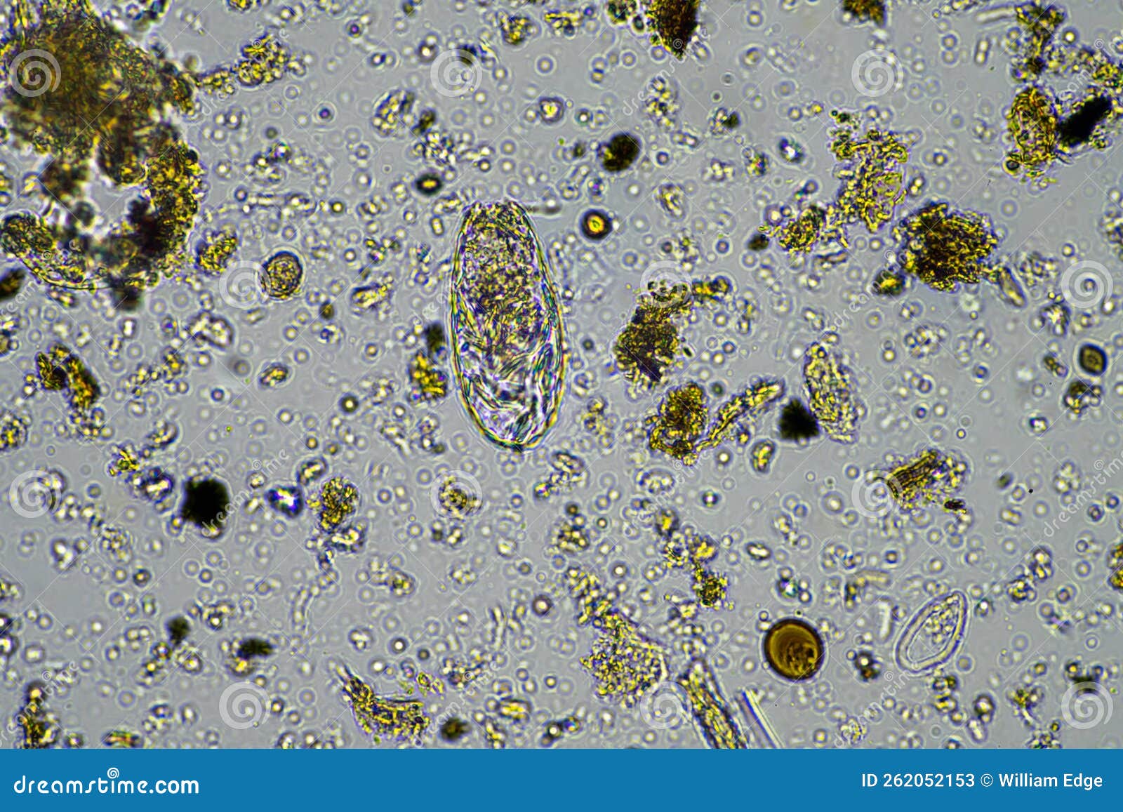 Human Parasites in the Human Gut Stock Image - Image of microscopy ...