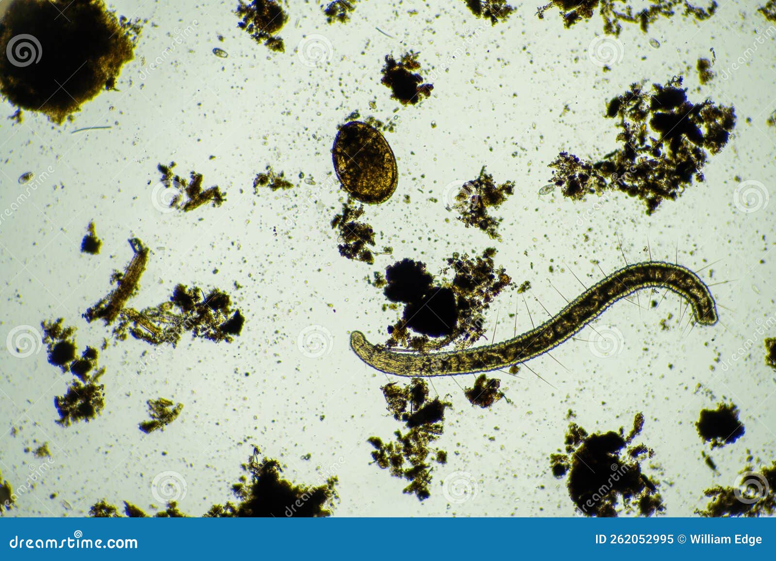 Human Parasites in the Human Gut Stock Image - Image of eating, move ...