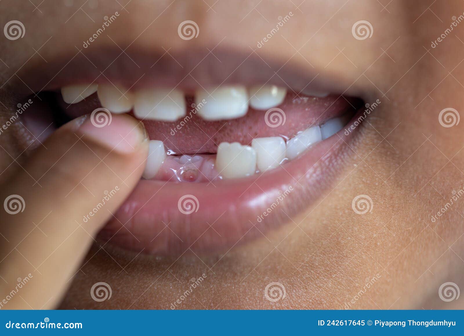 Human Parts Model in Science Lab. Stock Image - Image of model ...