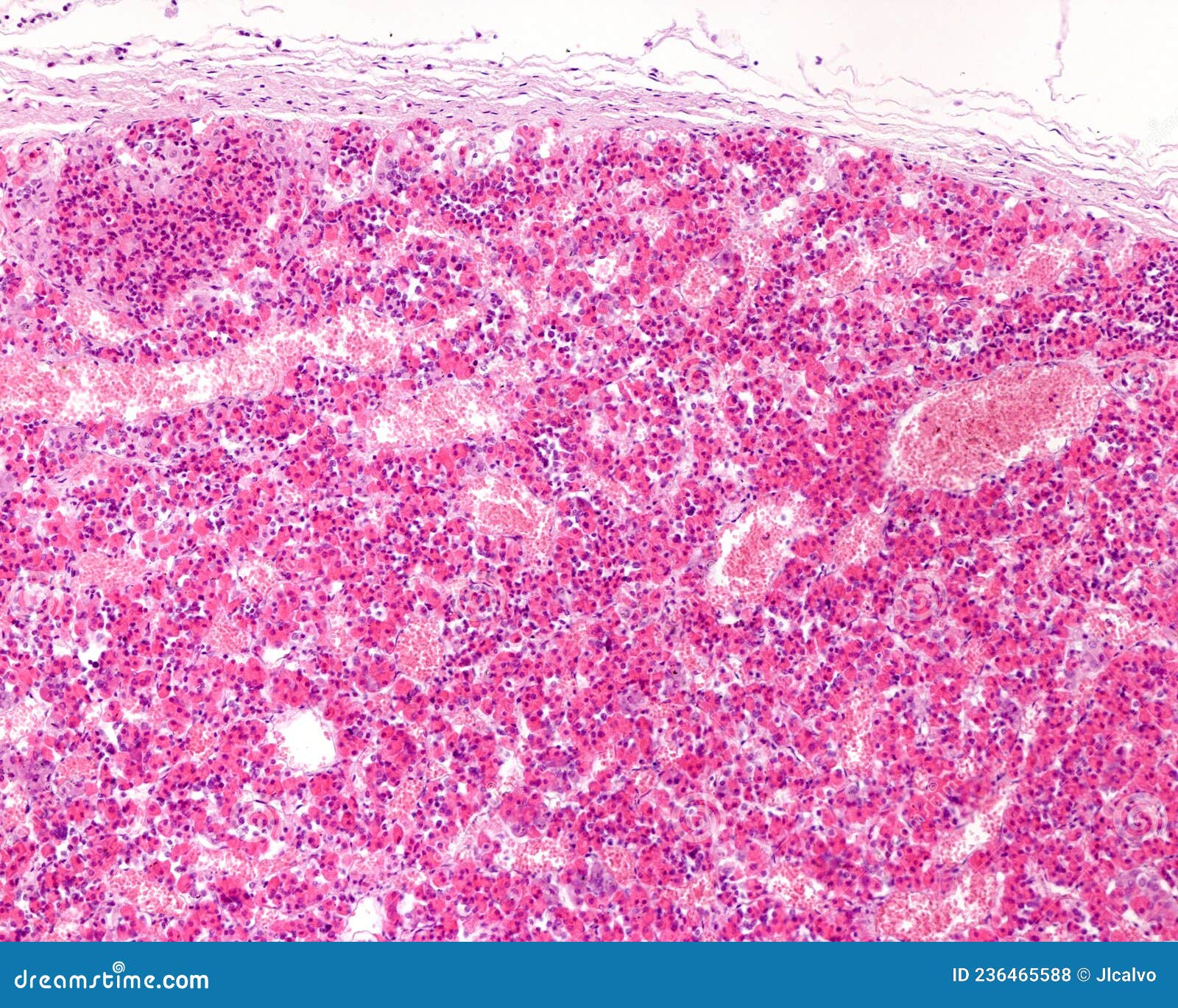 Human Pituitary. Anterior Lobe Stock Photo - Image of histological ...