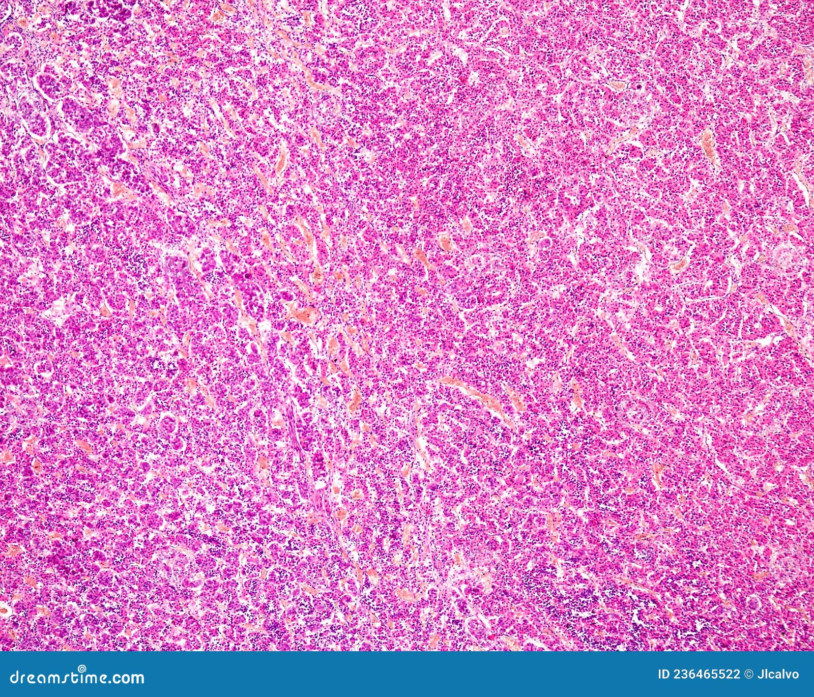 Human pituitary gland stock photo. Image of histological - 236465522