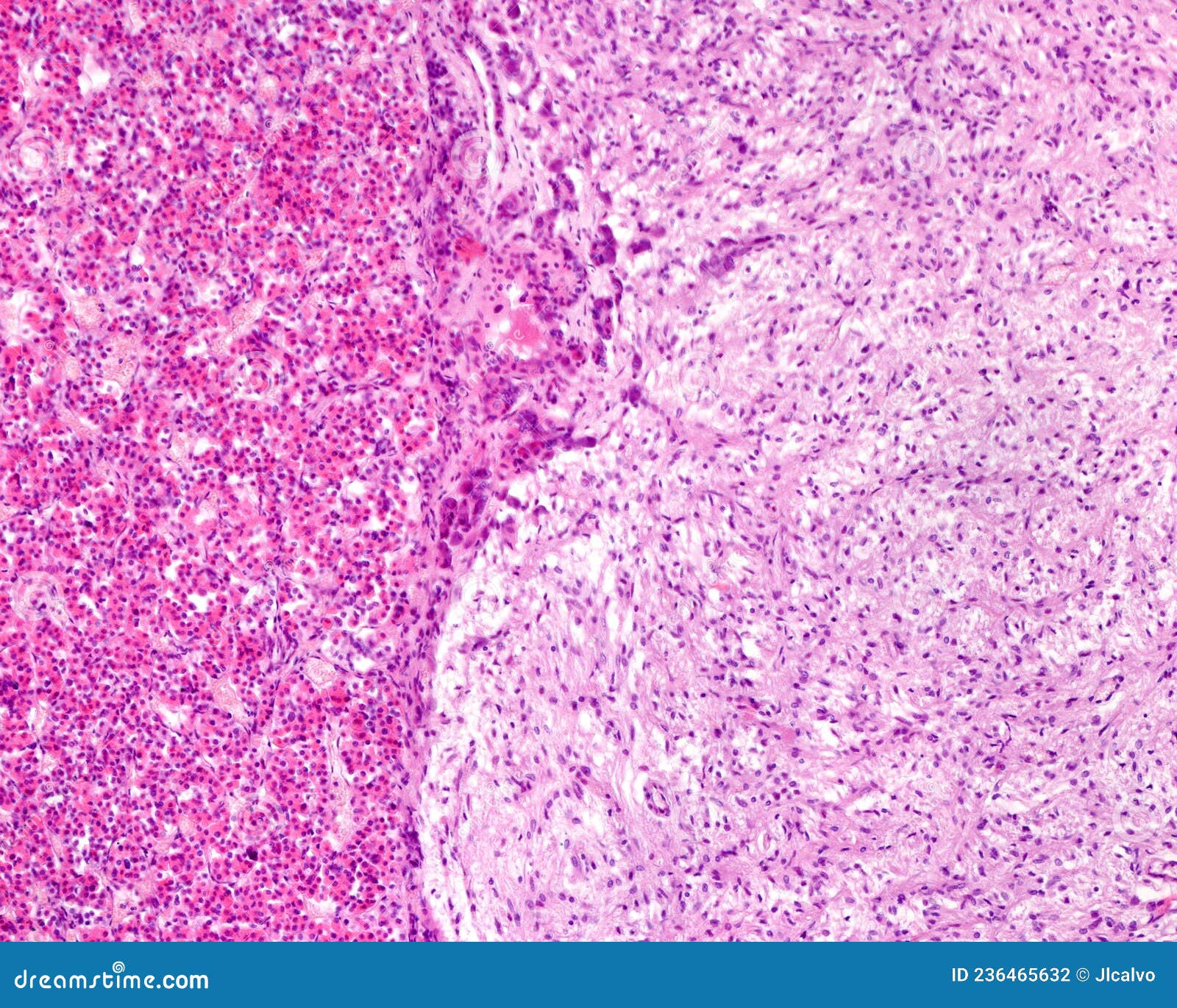 Human Pituitary. Intermediate Lobe Stock Photo - Image of intermediate ...