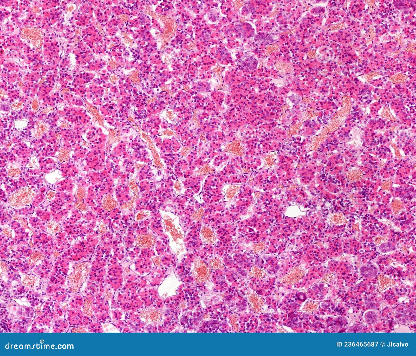 Human Pituitary. Lateral Wings of the Anterior Lobe Stock Image - Image ...