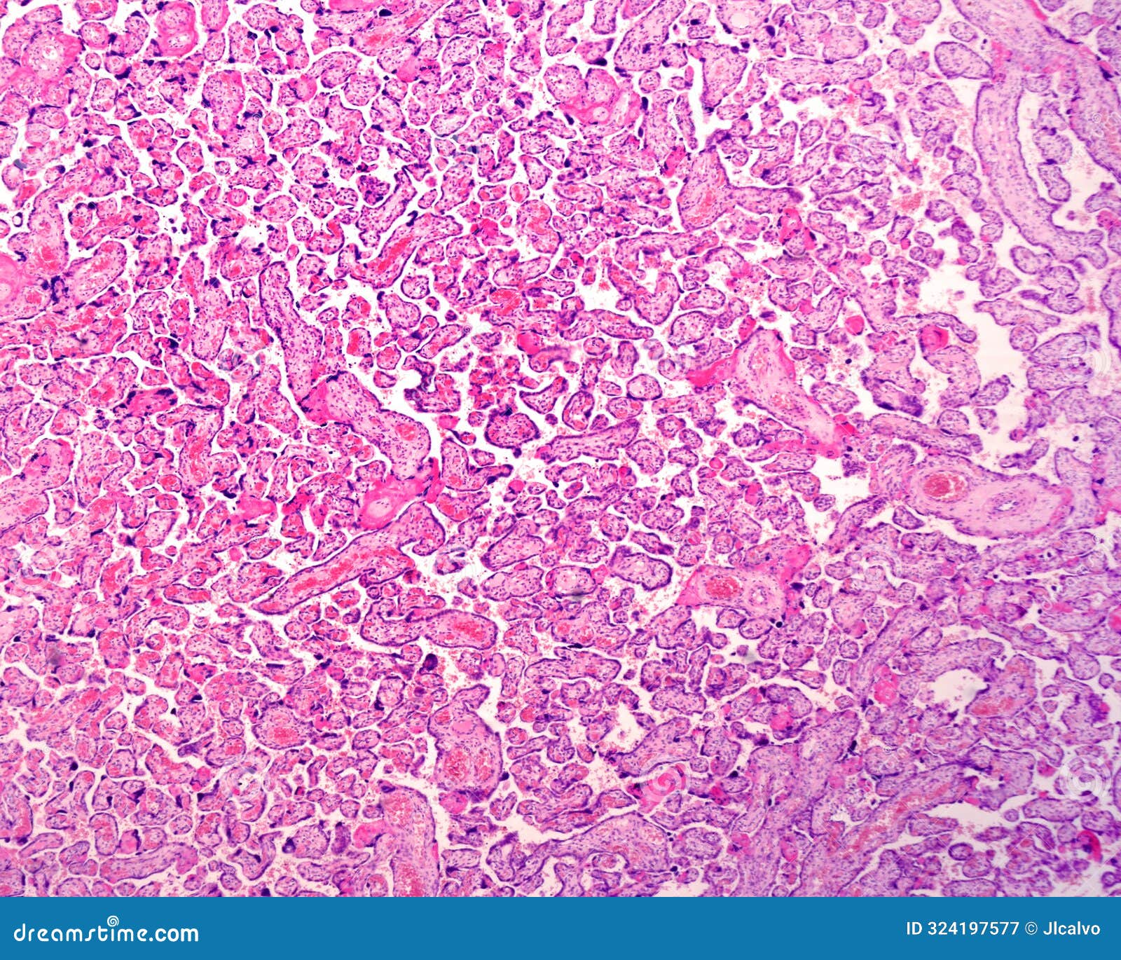 Human placenta stock image. Image of histology, tissue - 324197577