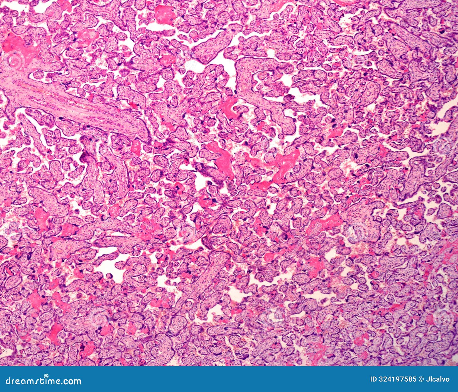 Human placenta stock image. Image of tissue, histological - 324197585