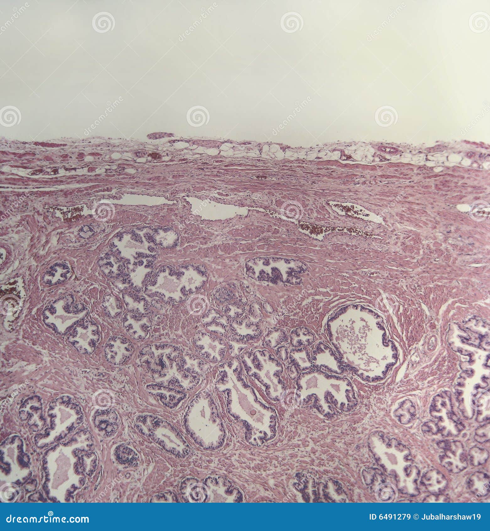 Human Prostate Gland, Microscopic Royalty Free Stock Images - Image ...