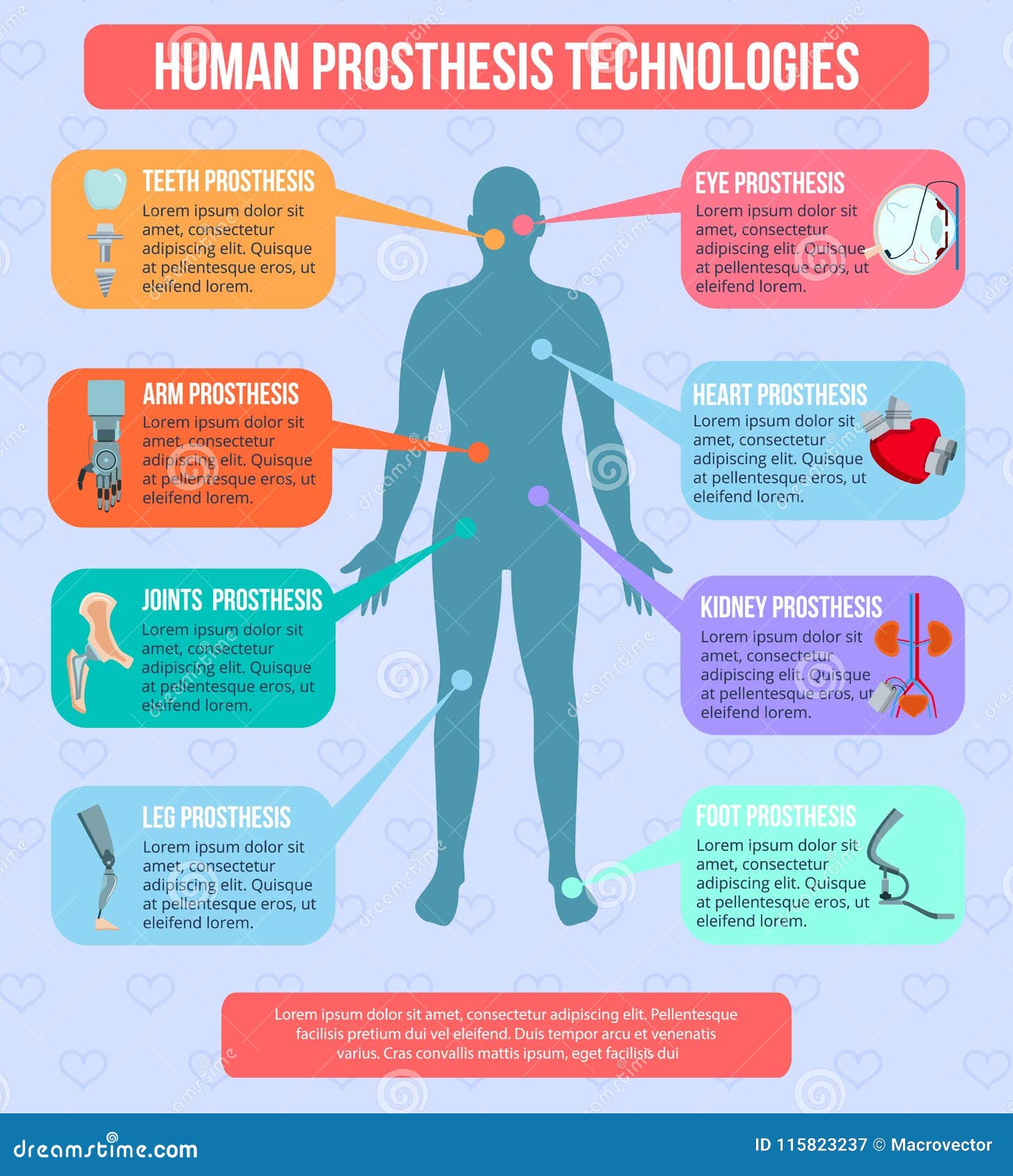 Human Prothesis Technologies Infographics Cartoon Vector ...