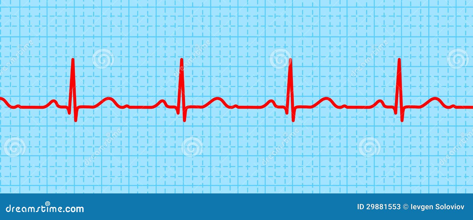 Human Pulse Stock Illustrations – 21,924 Human Pulse Stock ...