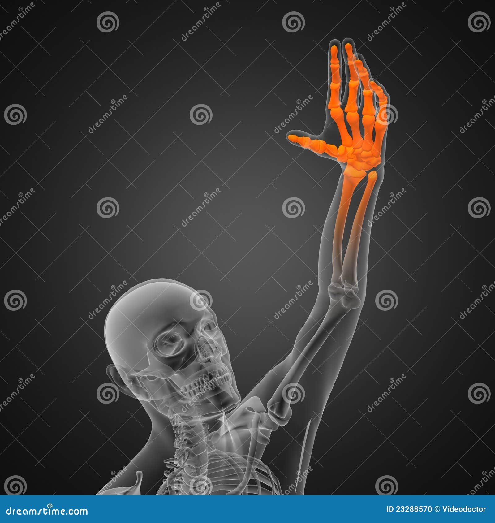 Human radiography scan stock illustration. Illustration of healthcare ...