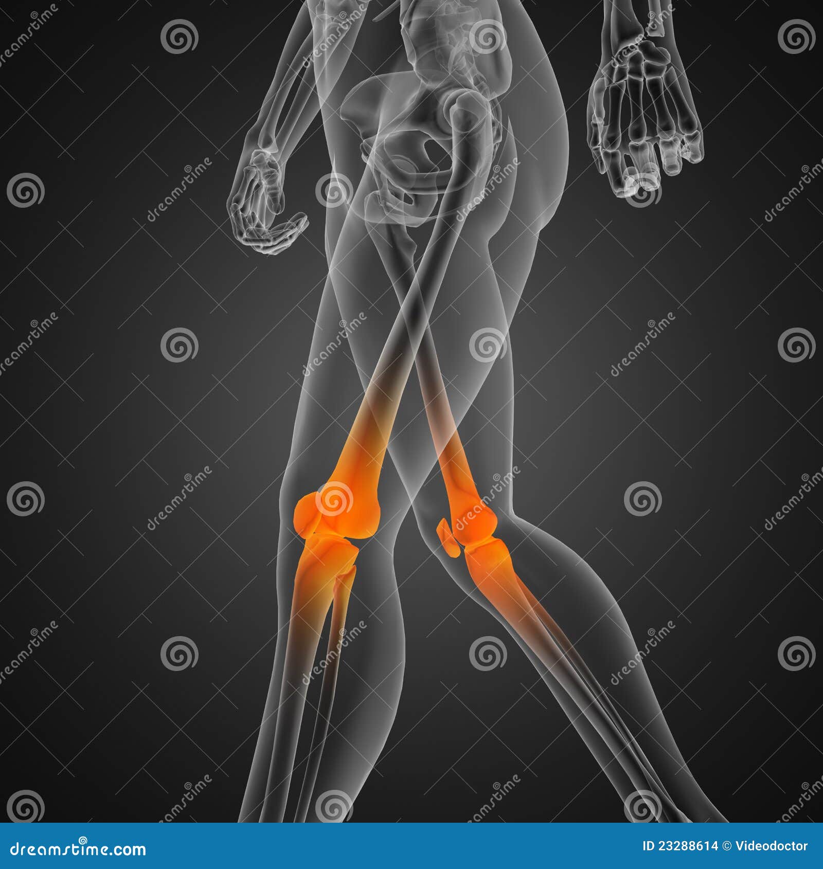 F1 Car Radiography Royalty-Free Stock Photography | CartoonDealer.com ...