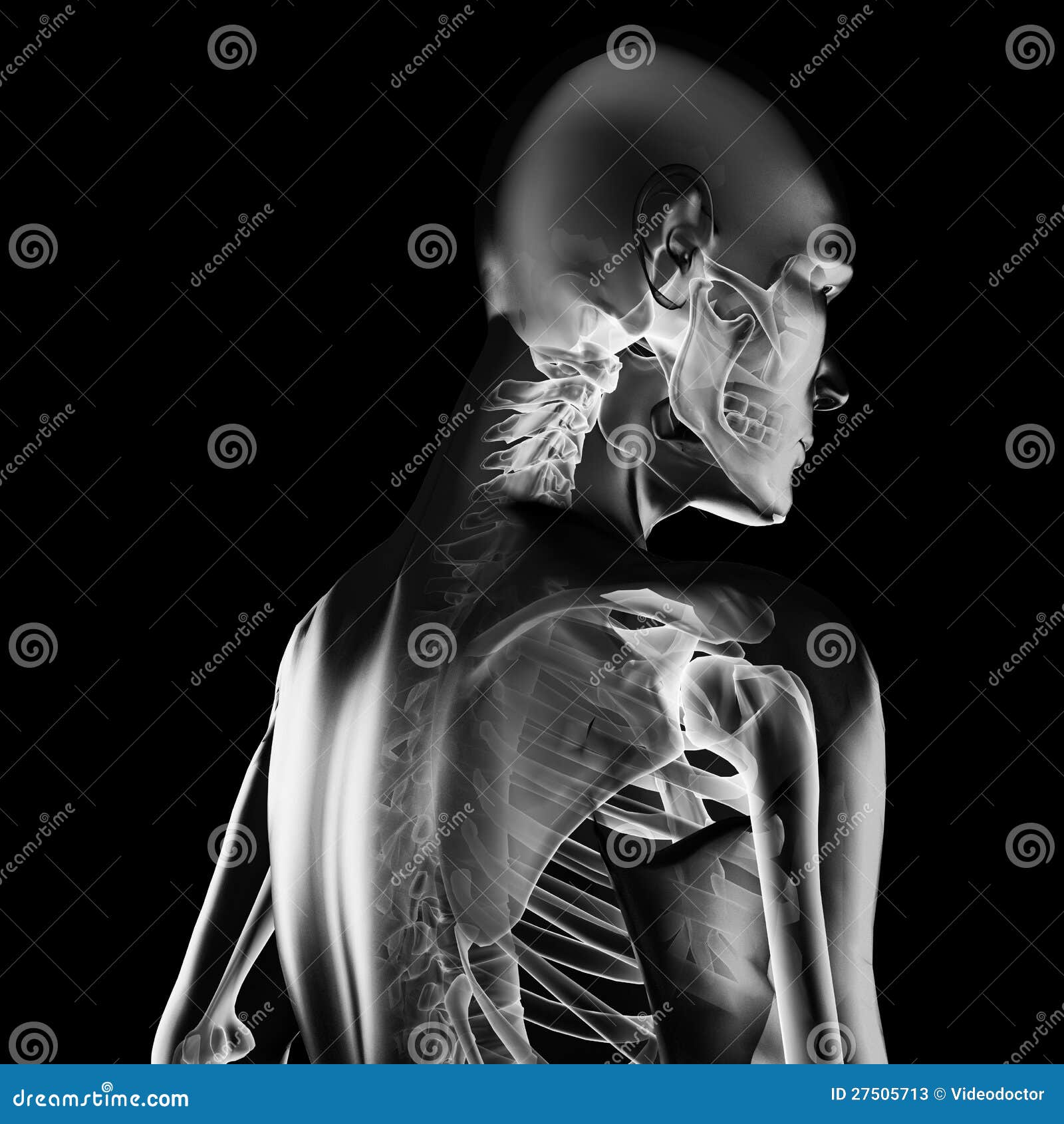 Human radiography scan stock illustration. Illustration of radiology ...