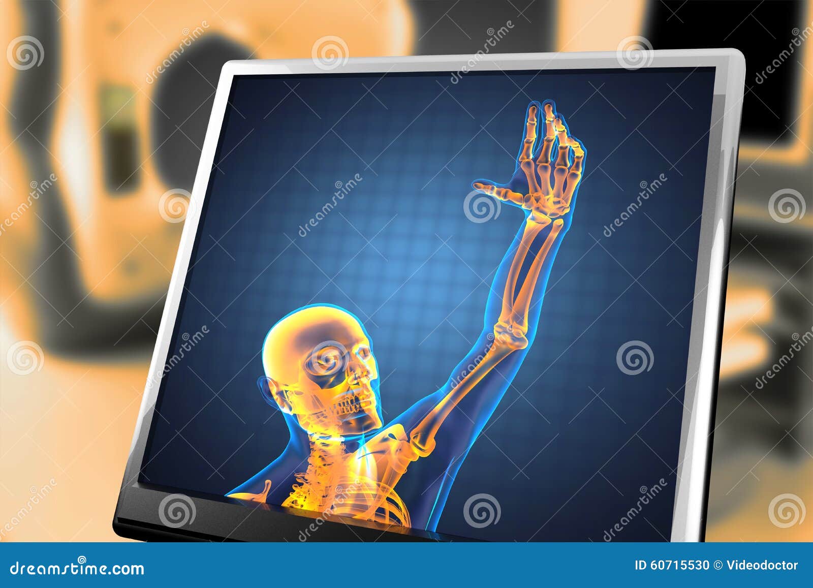 Human radiography scan stock photo. Image of patient - 60715530