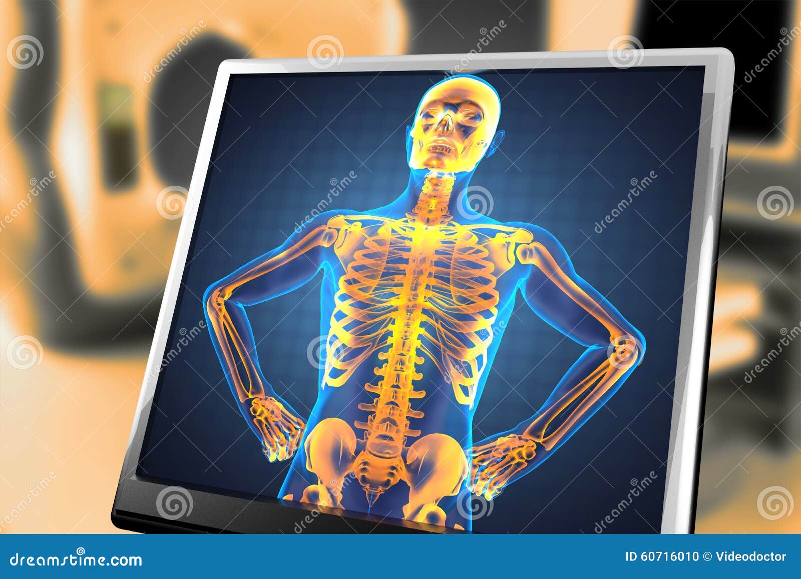 Human radiography scan stock illustration. Illustration of joint - 60716010