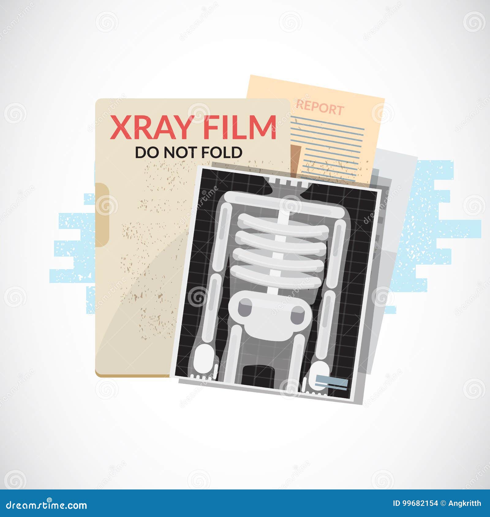 Human X-Ray Film with Paper and Folder. Medical Objects, File an Stock ...