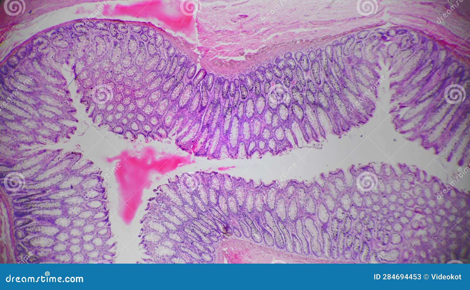 Human Rectum Tissue Magnified Under Microscope in 40 Times Against ...
